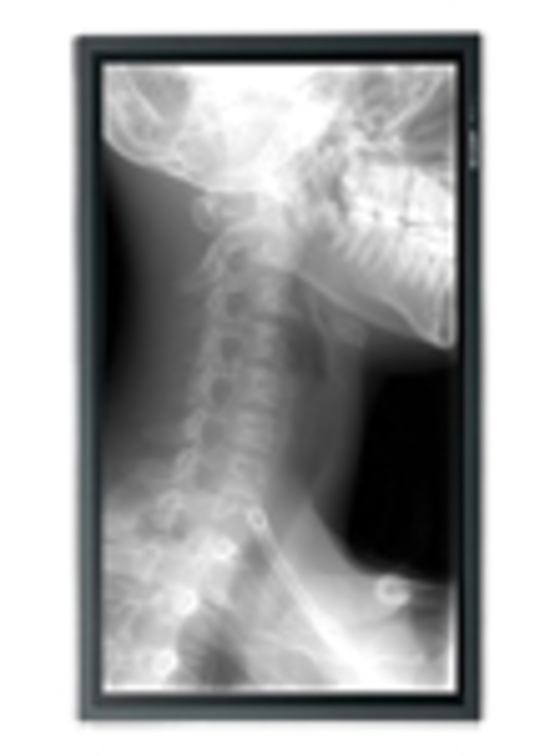 Portrait Mode LCD Monitor | Healthcare Innovation