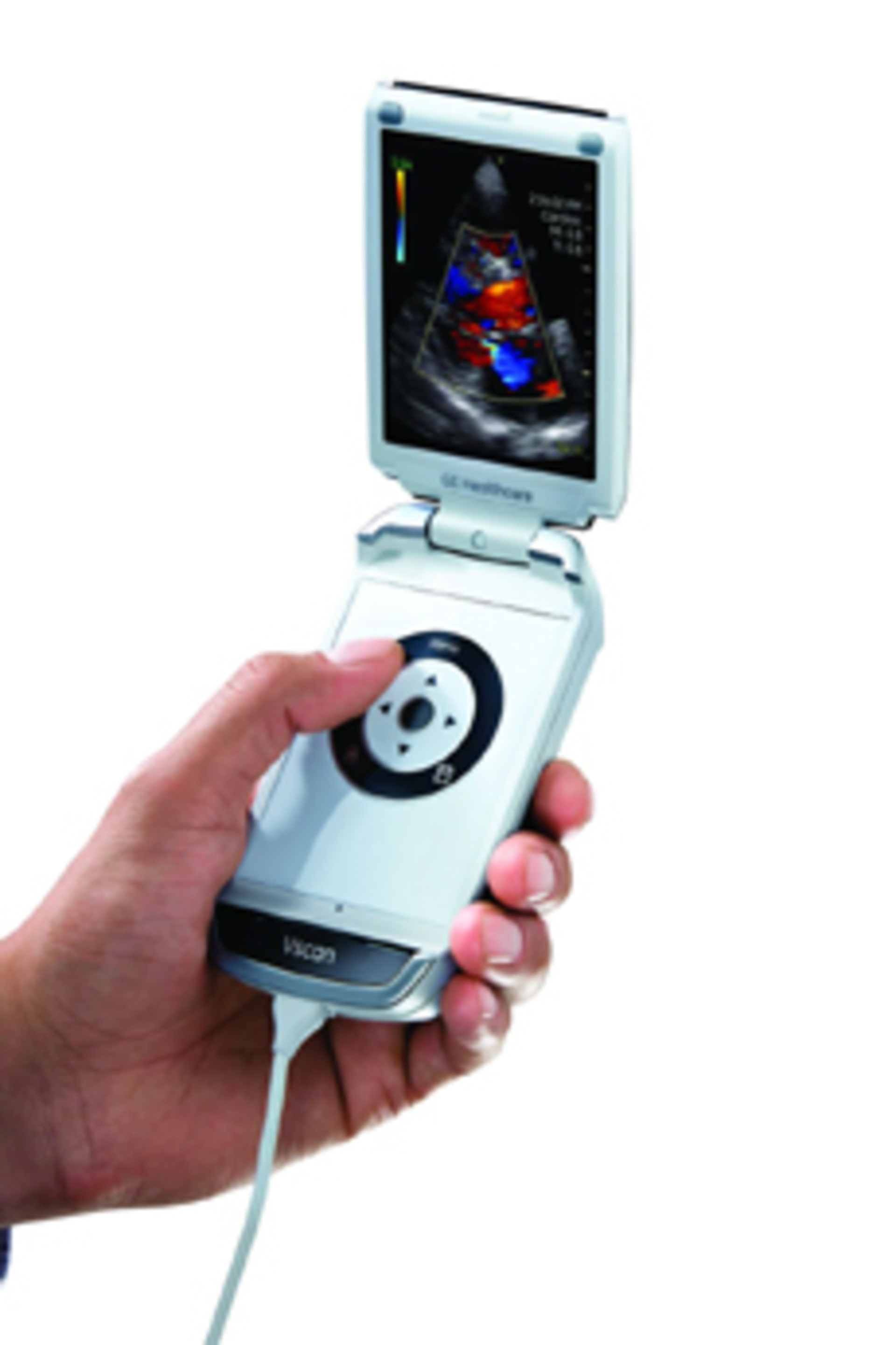 Pocket ultrasound reaches milestone | Healthcare Innovation