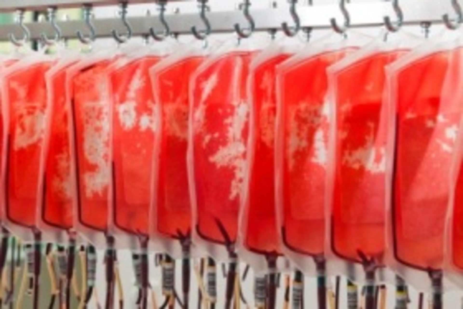 Analytics and the Optimization of Blood Products Utilization: Premier ...