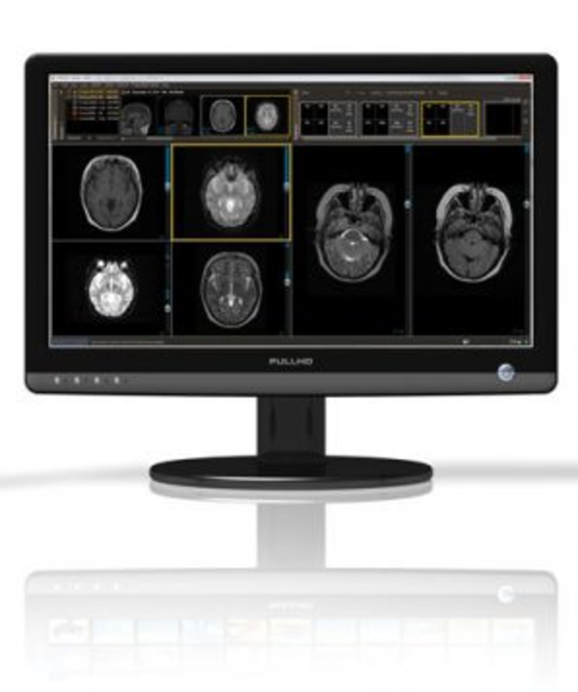 PACS/Imaging: Products – Nov/Dec 2017 | Healthcare Innovation