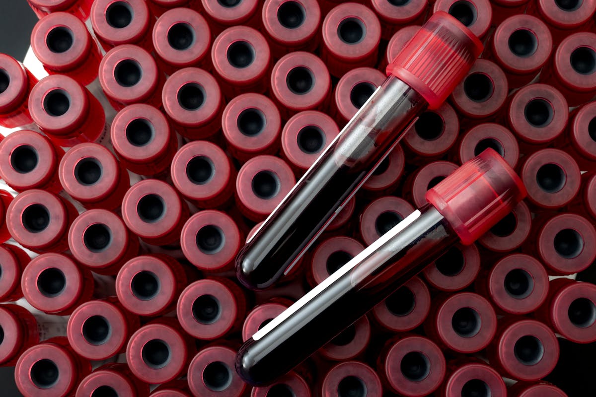 Labcorp, Getlabs Collaborate on At-Home Phlebotomy Service | Healthcare ...